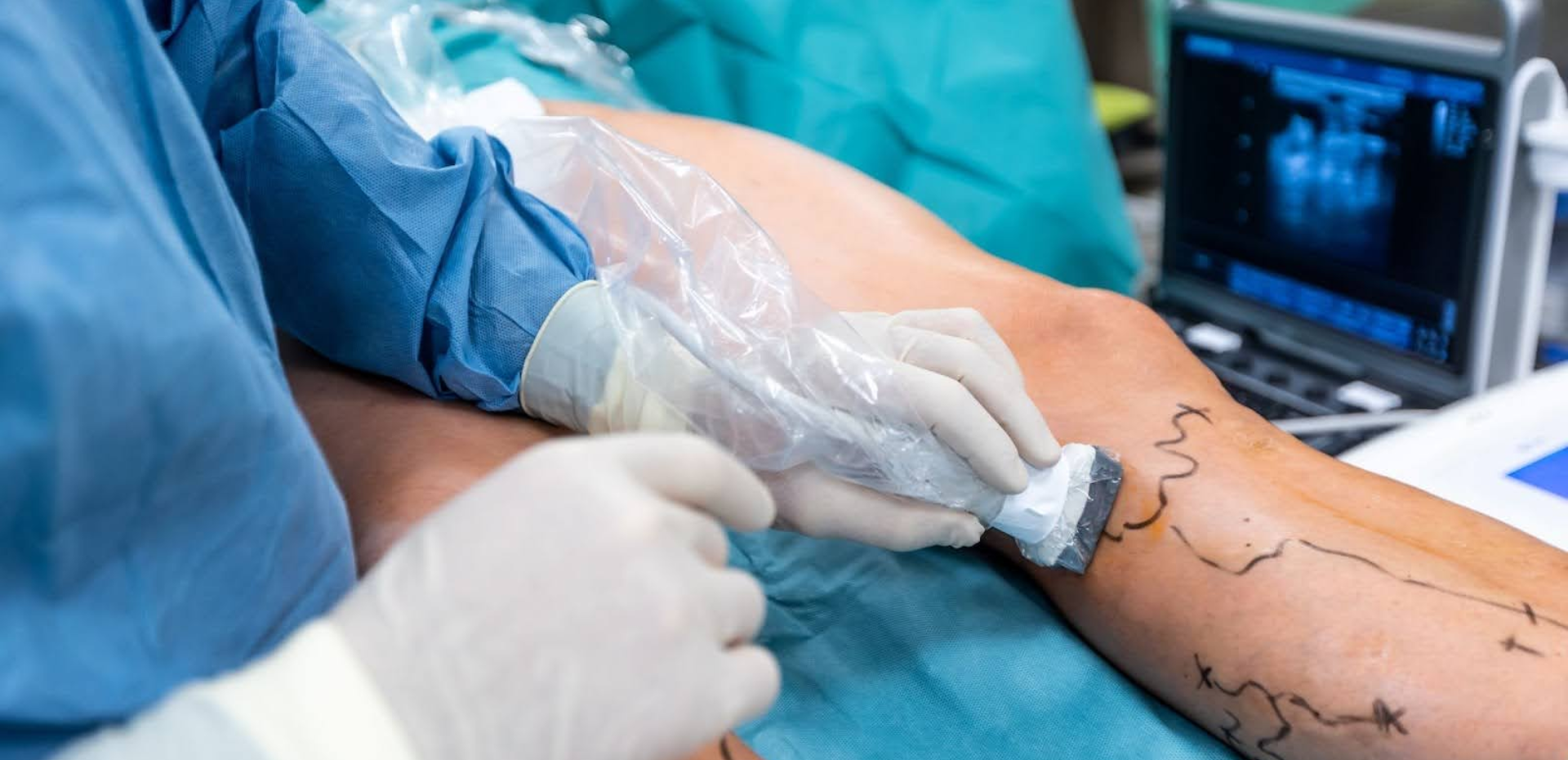 Expert Vascular Interventions in Hiranandani Estate, Thane - New Life Radiology Centre